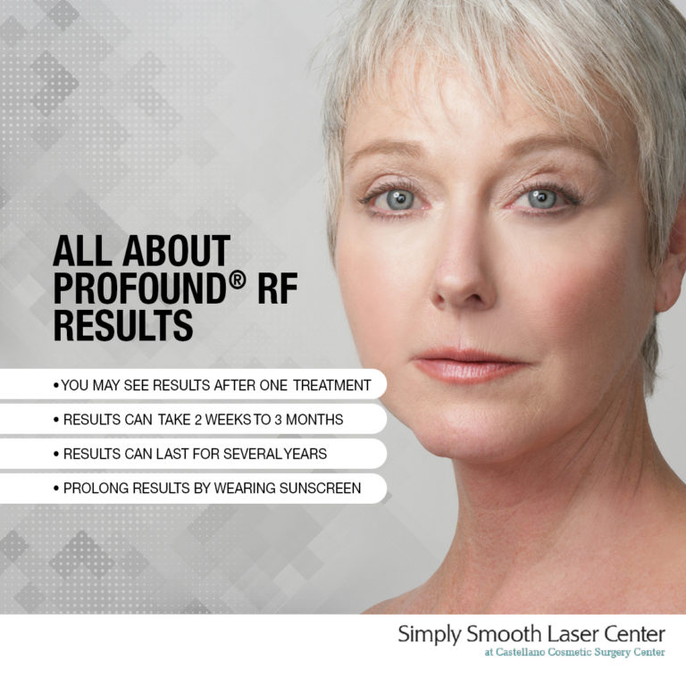 All About Profound® RF Results [Infographic]